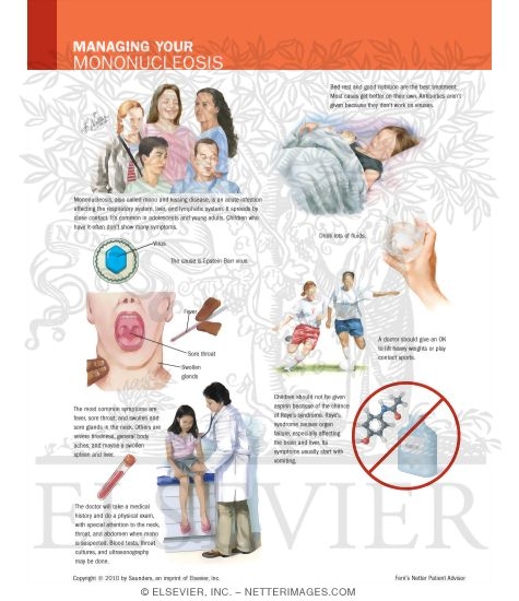 Managing Your Mononucleosis