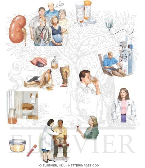 Managing Your Rhabdomyolysis