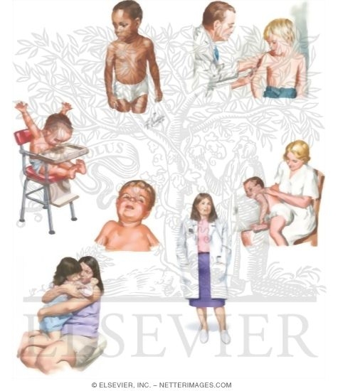 Caring for Your Child With Fever Seizures