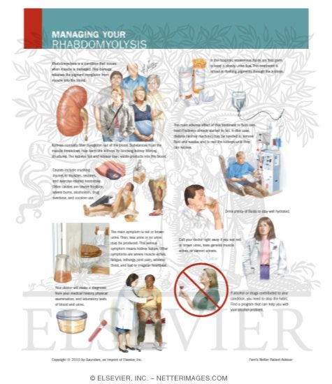 Managing Your Rhabdomyolysis