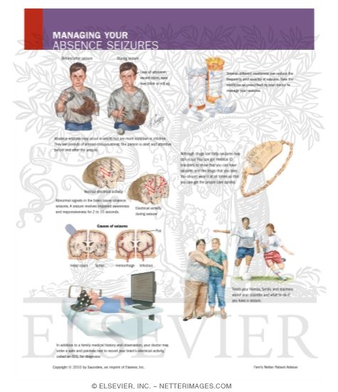 Managing Your Absence Seizures