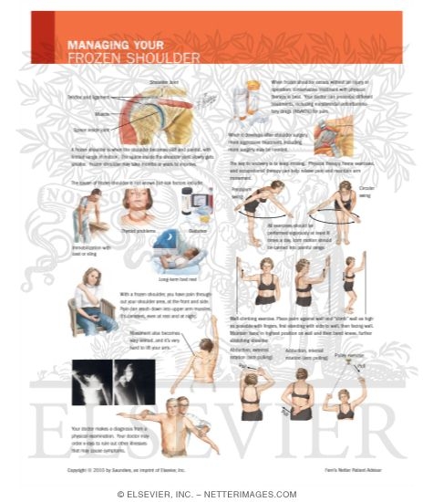 Managing Your Frozen Shoulder
