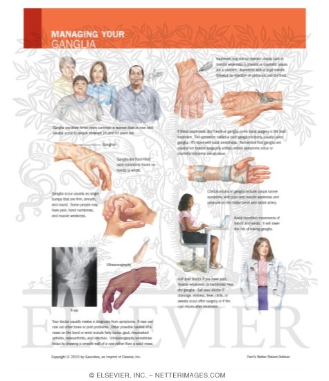 Managing Your Ganglia