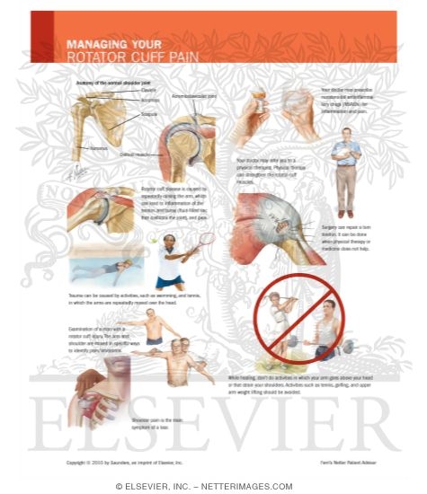 Managing Your Rotator Cuff Pain