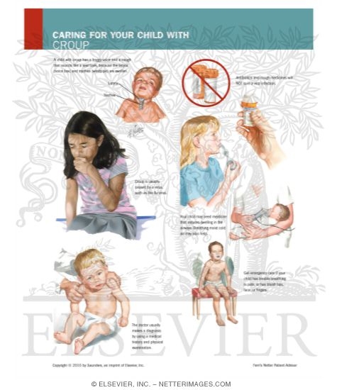 Caring for Your Child With Croup