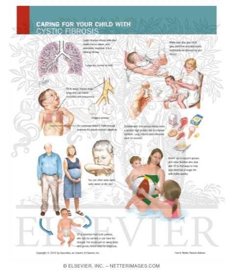 Caring for Your Child With Cystic Fibrosis