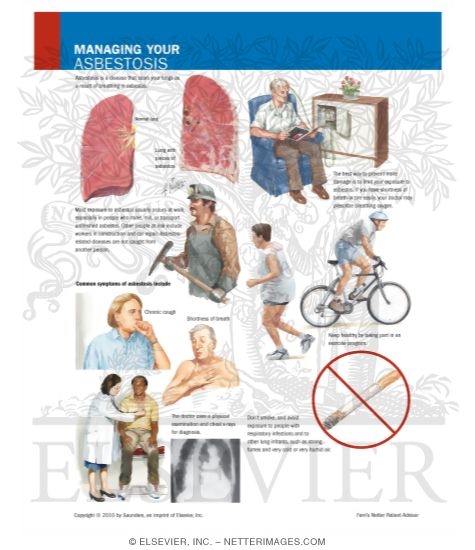 Managing Your Asbestosis