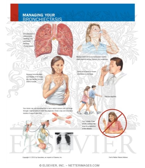 Managing Your Bronchiectasis