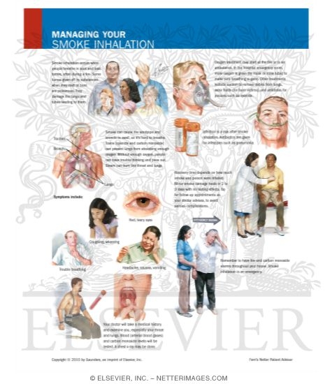 Managing Your Smoke Inhalation