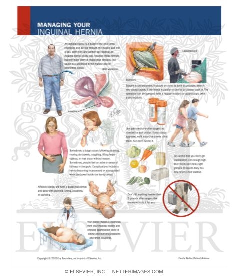 Inguinal Hernia Anatomy Netter