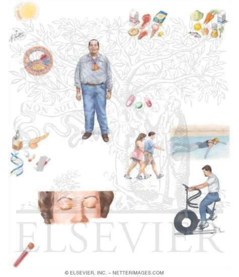 Managing Your High Triglycerides