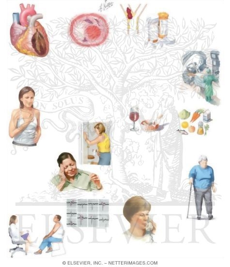 Managing Your Heart Attack: For Women