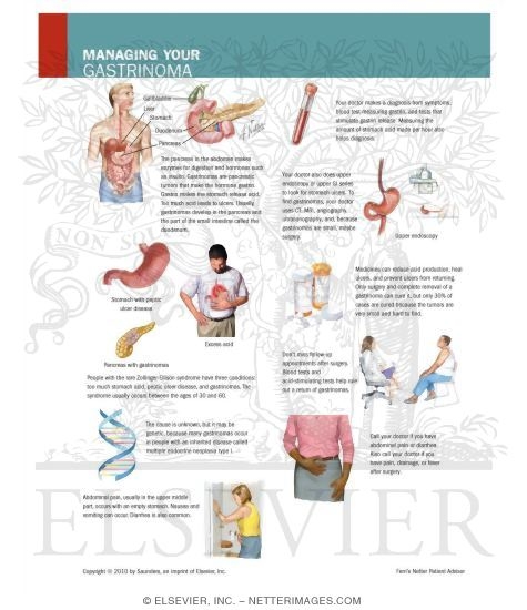 Managing Your Gastrinoma