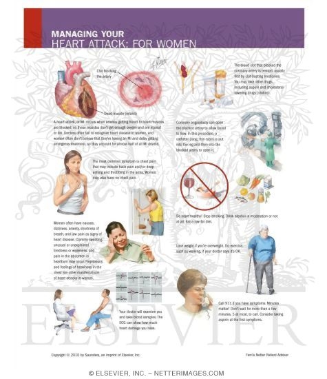 Managing Your Heart Attack: For Women