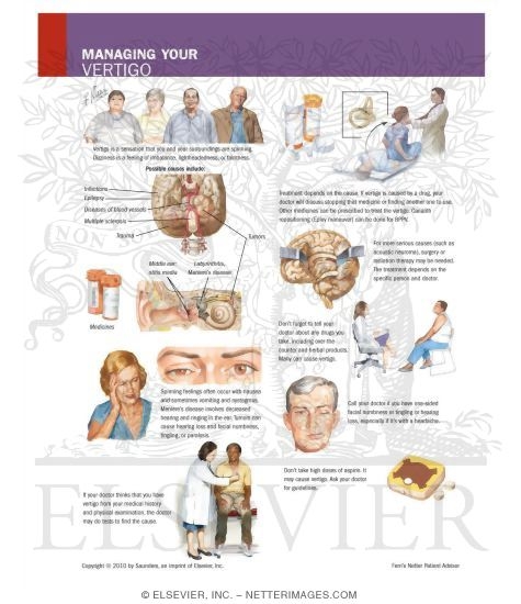 Managing Your Vertigo