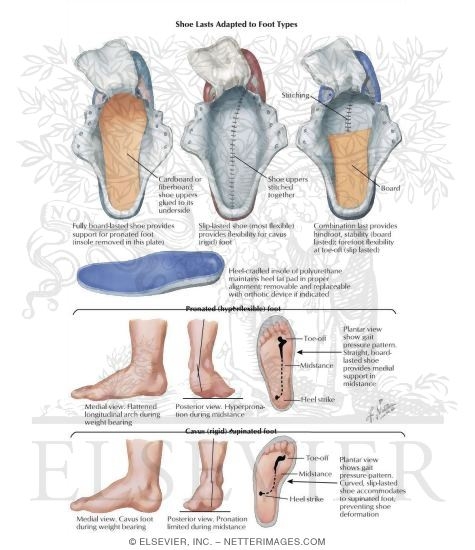 Varieties of Shoe Last: Adaptation to Foot Types