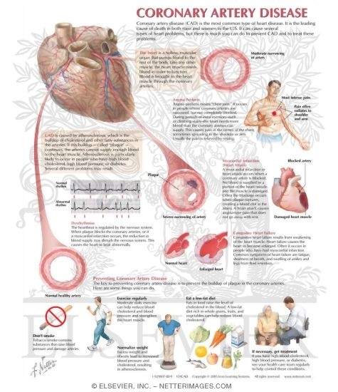 Coronary Artery Disease