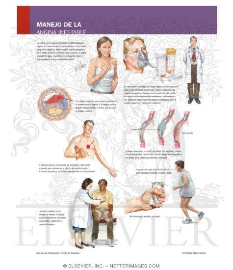 Managing Your Unstable Angina