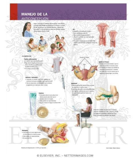 Understanding Your Options: Contraception