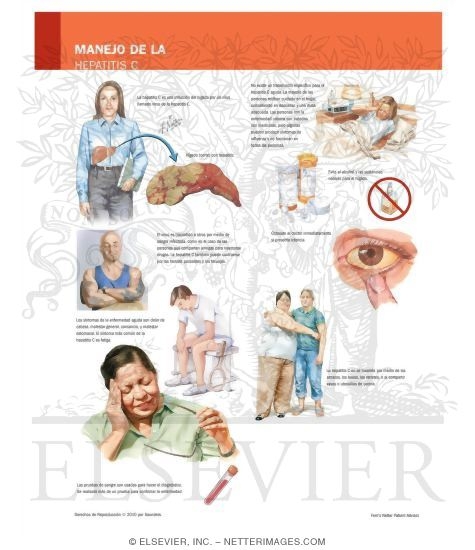 Watermarked preview of labeled image: Managing Your Hepatitis C