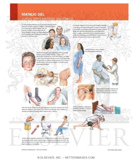 Managing Your Systemic Lupus Erythematosus