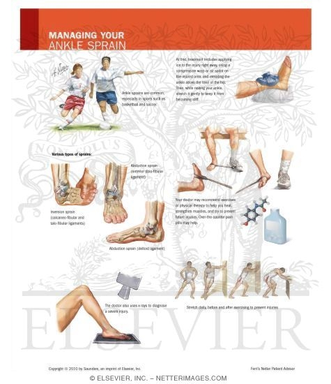 Managing Your Ankle Sprain