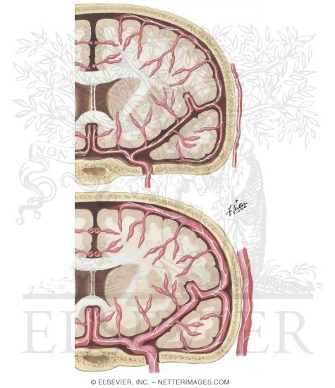 Theory Of Migraine Etiology