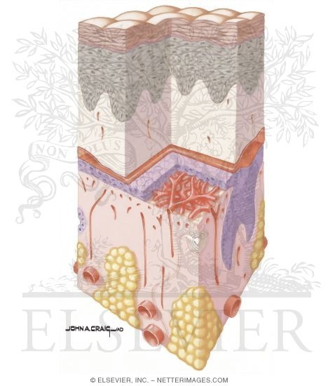 Burn Wound Healing With Xenograft Used As Biologic Dressing