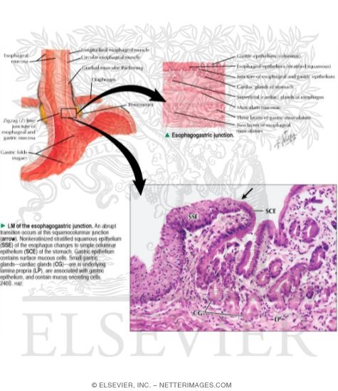 Gastroesophageal Junction Slide Labeled
