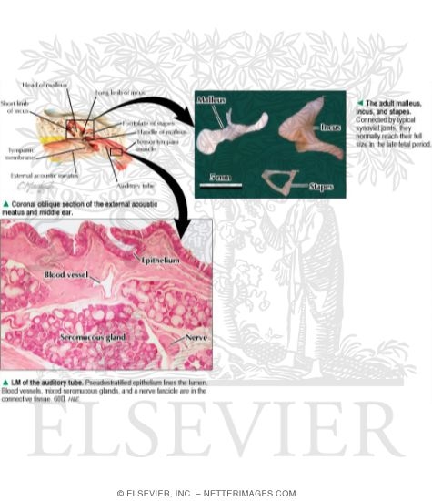 Coronal Oblique Section of the External Acoustic Meatus and Middle Ear ...