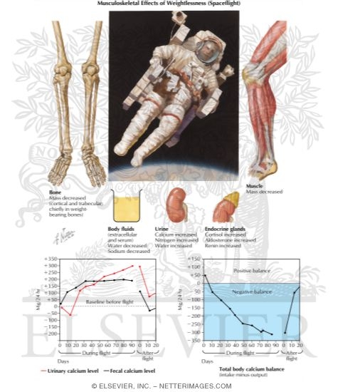 Musculoskeletal Effects of Weightlessness (Spaceflight)