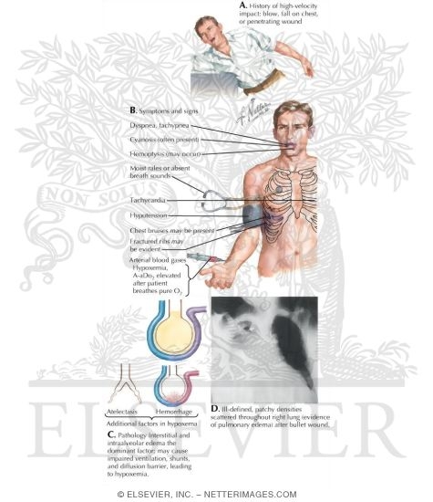 perforating wound drawing