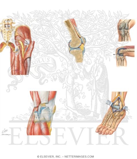 Lower Extremity Injections
