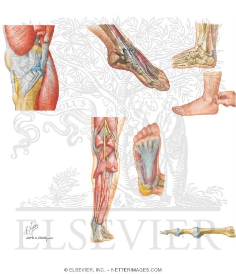 Lower Extremity Injections