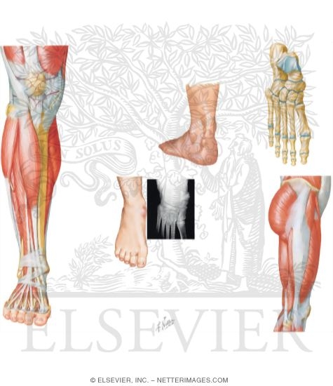 Figure Skating Injuries