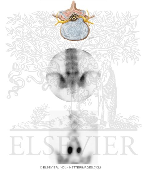 Low Back Injuries In Rowing