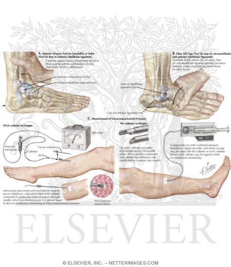 Special Tests for the Leg and Ankle