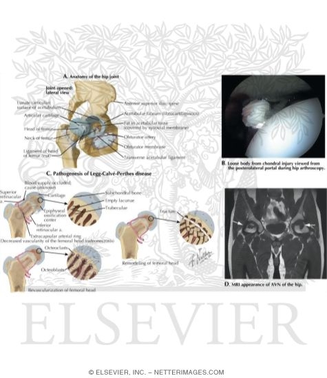 Hip Injuries and Problems