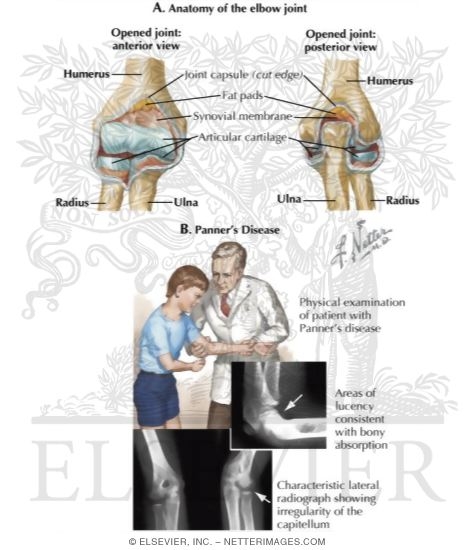 Elbow Injuries and Problems