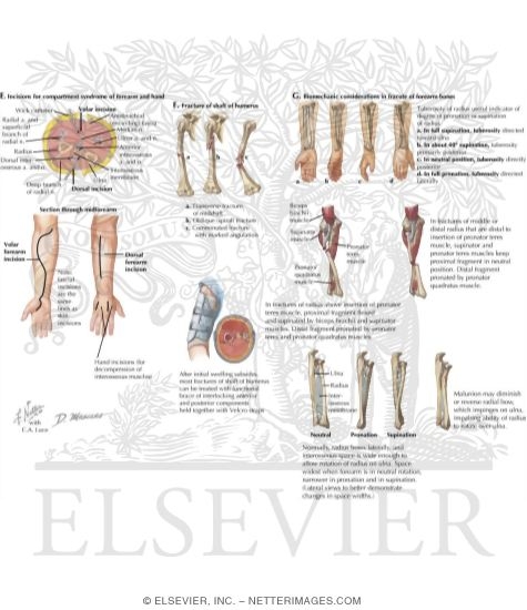 Upper Extremity Fractures and Dislocations