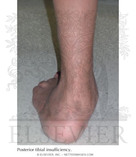 Too Many Toes Test too-many-toes-test
