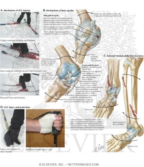 Skiing Injuries