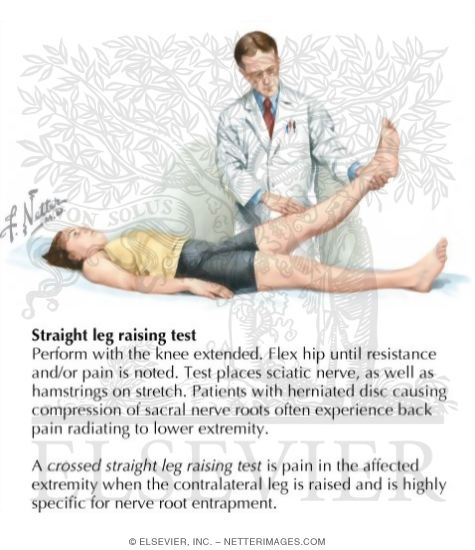 Straight Leg Raise Test Straight Leg Raise Test