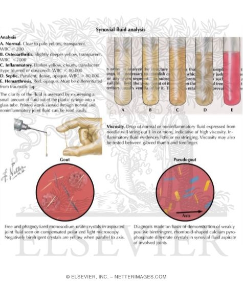 synovial fluid coloring pages