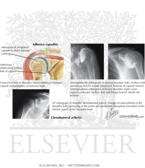 Shoulder Joint, Supraspinatus Muscle
