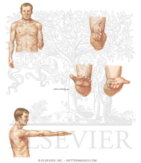 Physical Examination of the Arm