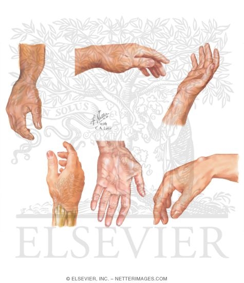 Physical Examination of the Forearm