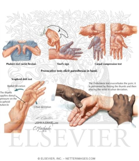 Physical Examination of the Forearm