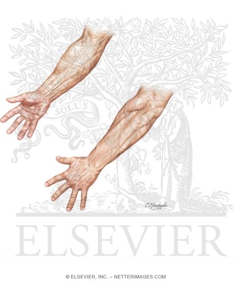 Topographic Anatomy of the Hand