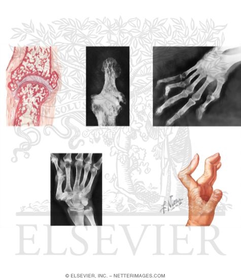 Disorders of the Hand